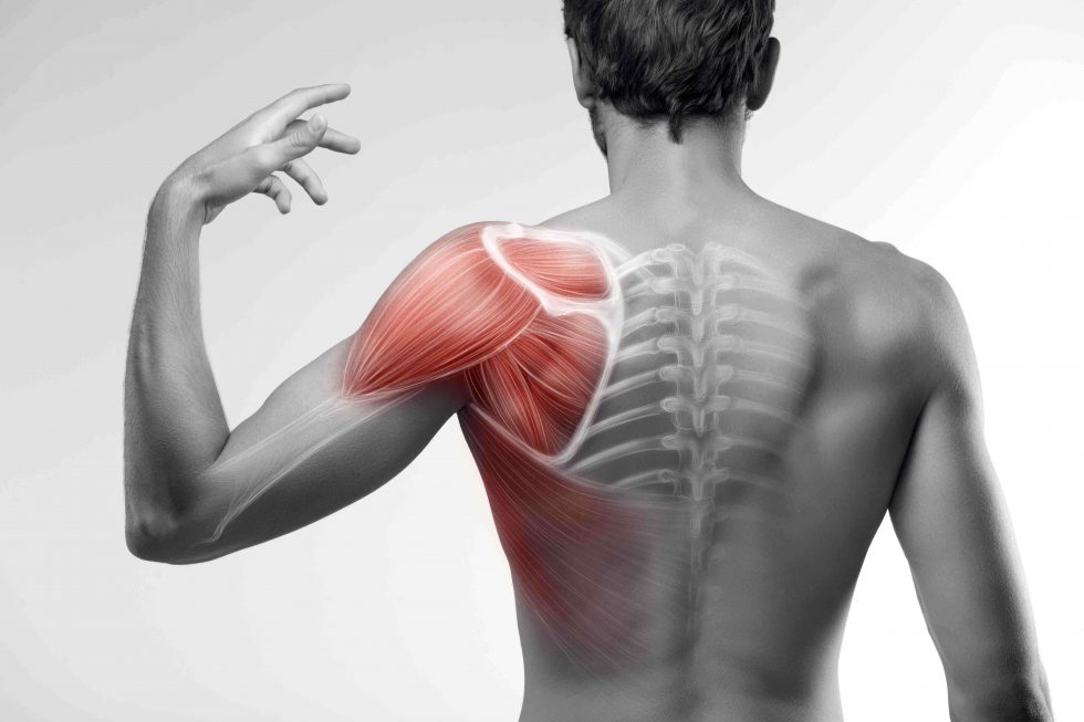 Distal Clavicle Excision: AC Joint Surgery | AOA