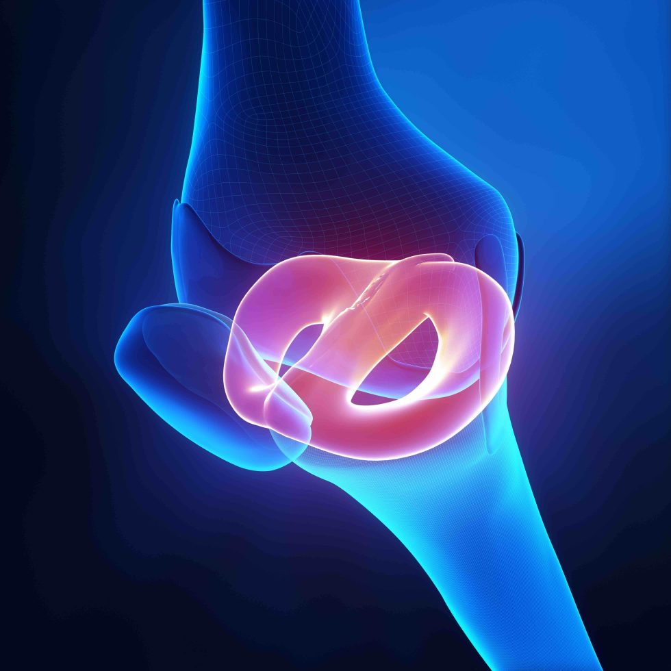 Discoid Meniscus: Types, Symptoms & Treatment | AOA
